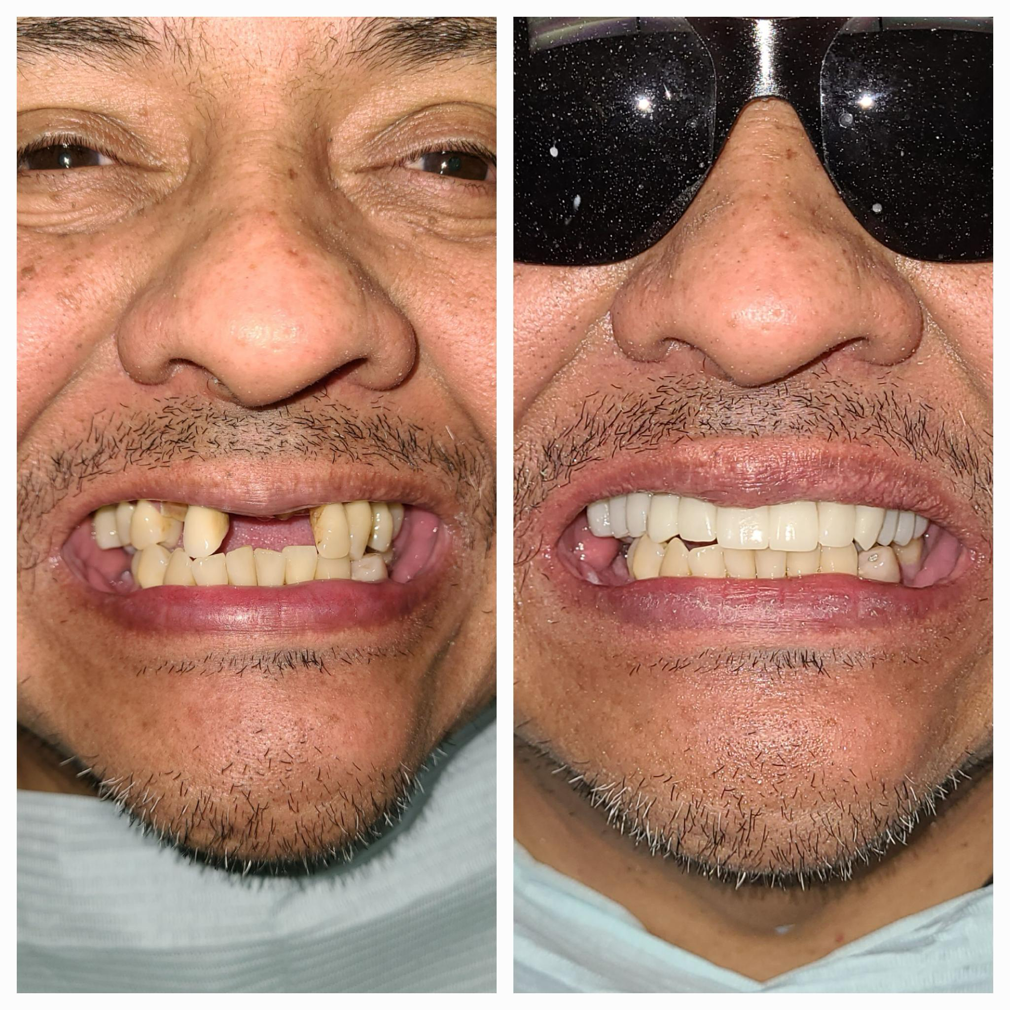 Before & After Gallery: Transformations with Dental Procedures ...