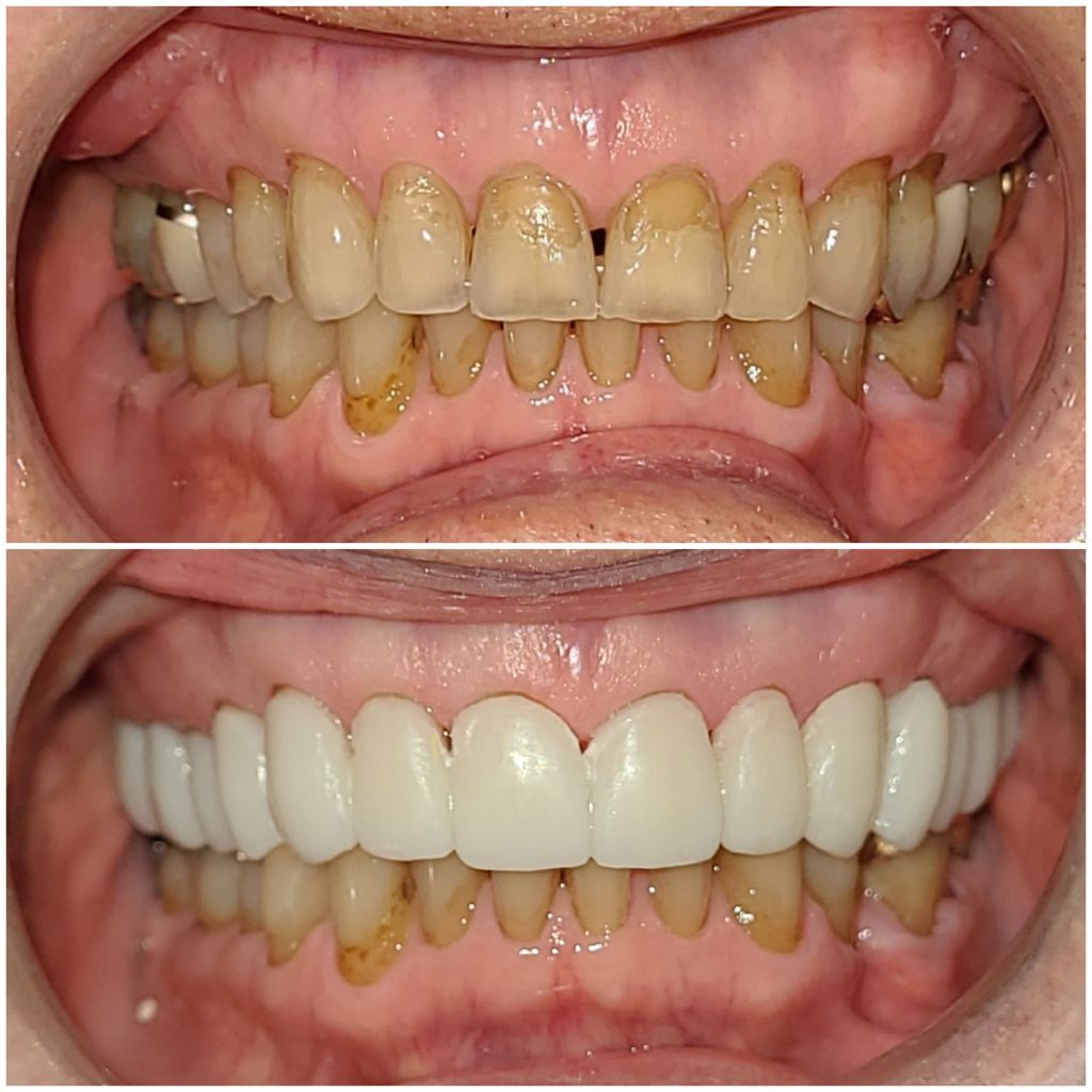 Before & After Gallery: Transformations with Dental Procedures ...