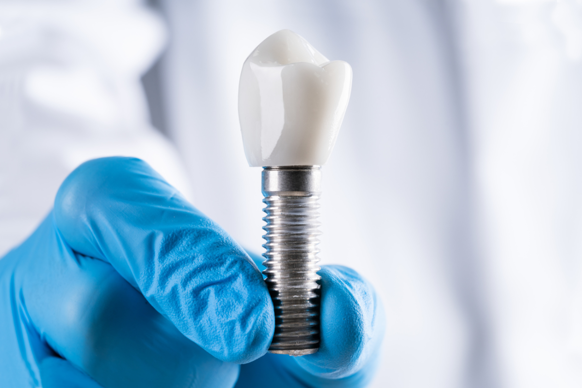 The Process of Removing a Dental Implant - Arizona Dental Specialists