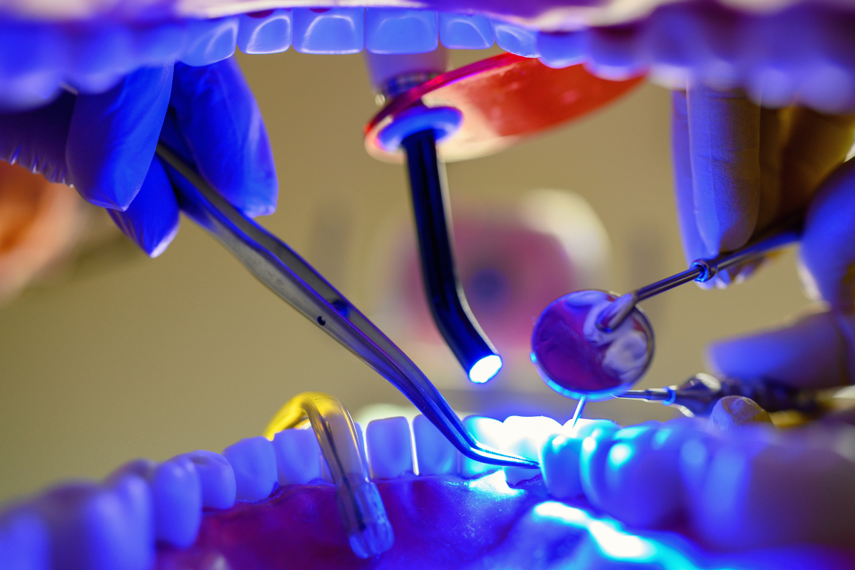 What to Do If You Suspect You Have Dry Socket - Arizona Dental Specialists